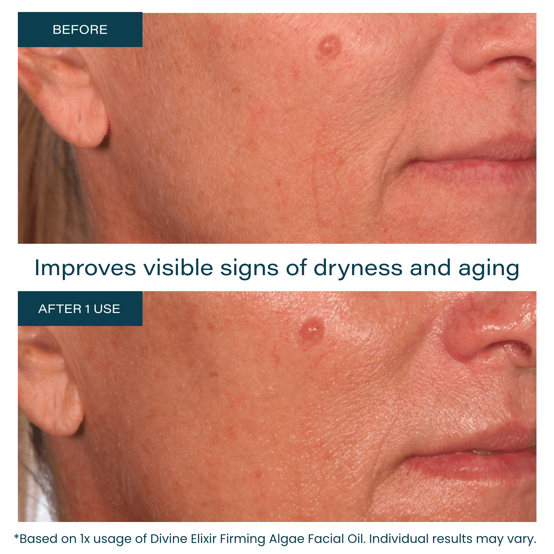 Firming Algae Facial Oil – SKINN