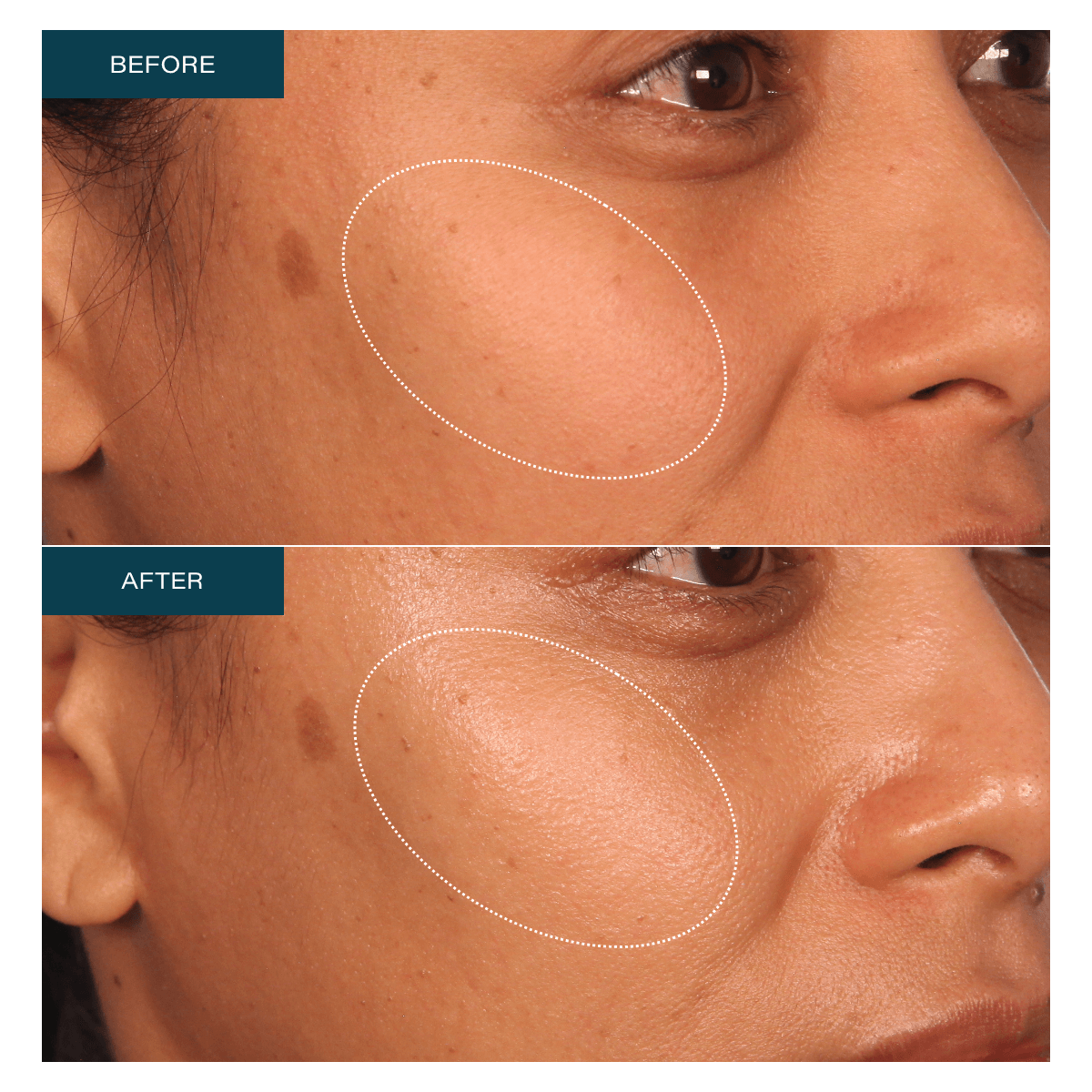 Luminous Firming Cream – SKINN