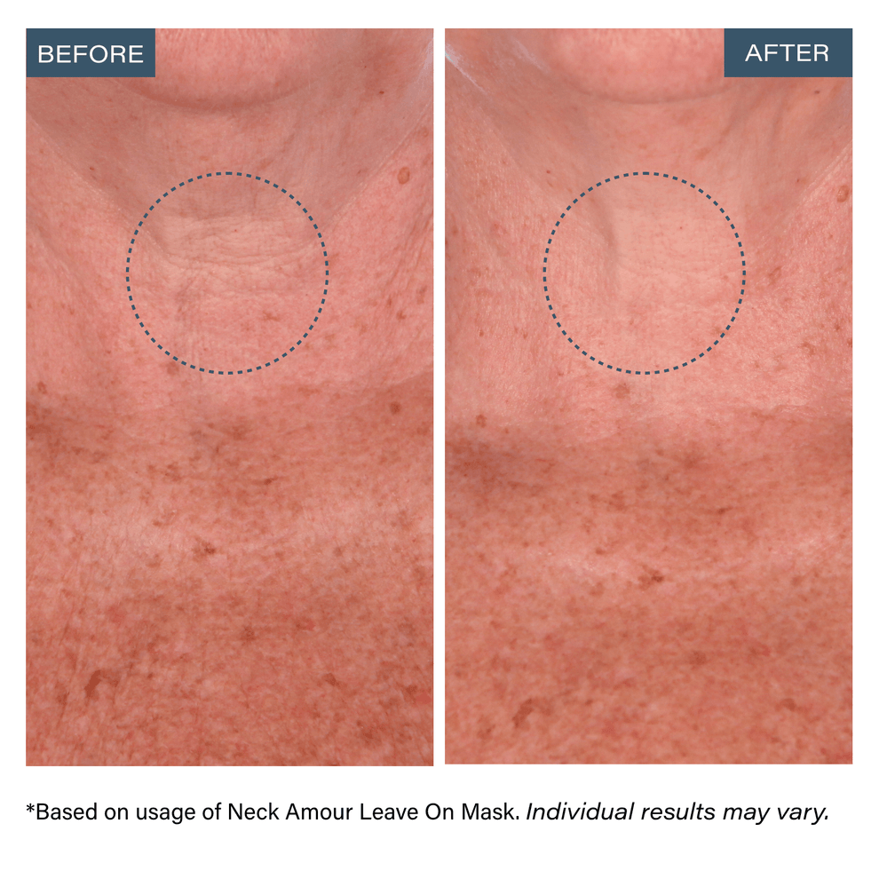 Skinn Cosmetics: Leave-On Mask with Rice Protein + Probiotics Comfort ...